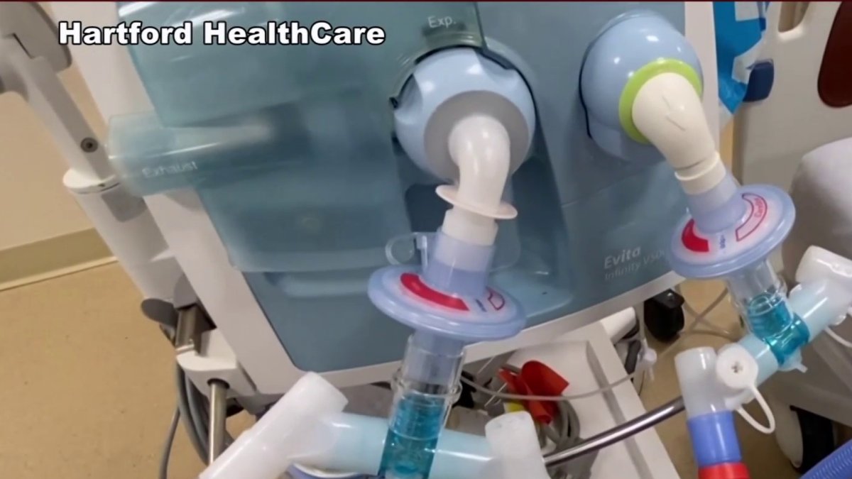 Fear of Ventilator Shortage Prompts Search, New Methods – NBC Connecticut Fear of Ventilator Shortage Prompts Search, New Methods – NBC Connecticut