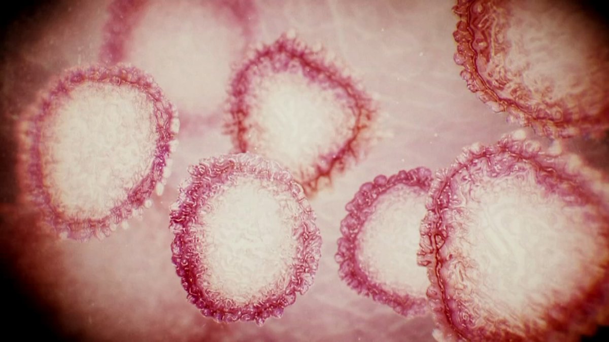 Person in New Haven Asked to Self-Isolate Over Coronavirus Concern ...