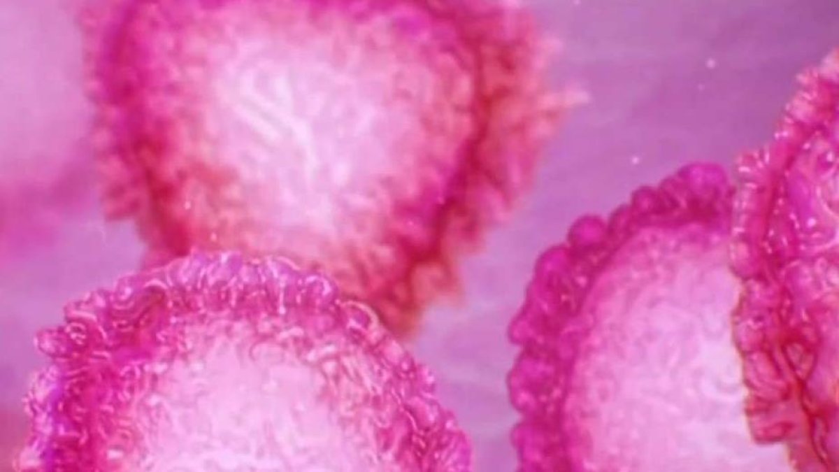 Rhode Island DOH Confirms First Positive Case of Coronavirus – NBC ...