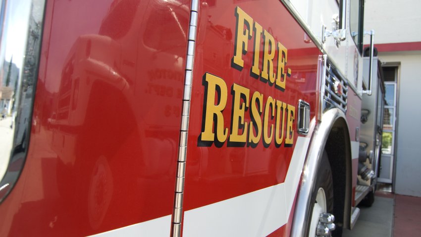 4 People Injured After Fire Pit Incident in Simsbury – NBC Connecticut