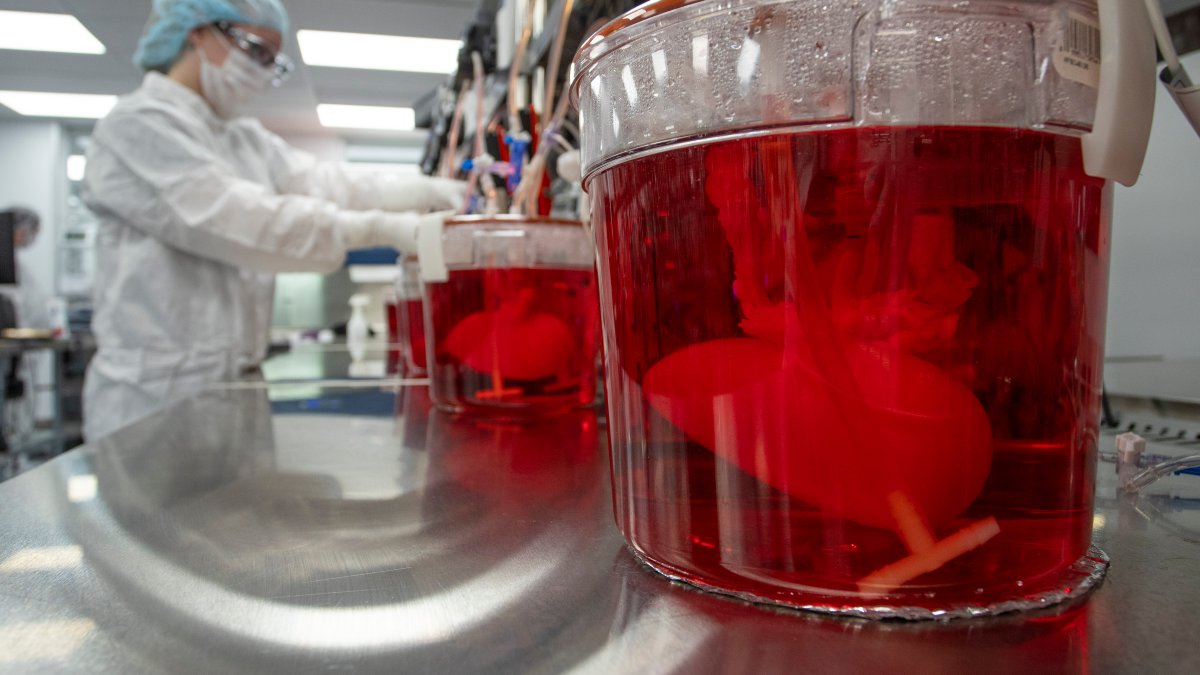 Scientists Seek to Use Pig Livers to Ease Organ Shortage – NBC Connecticut