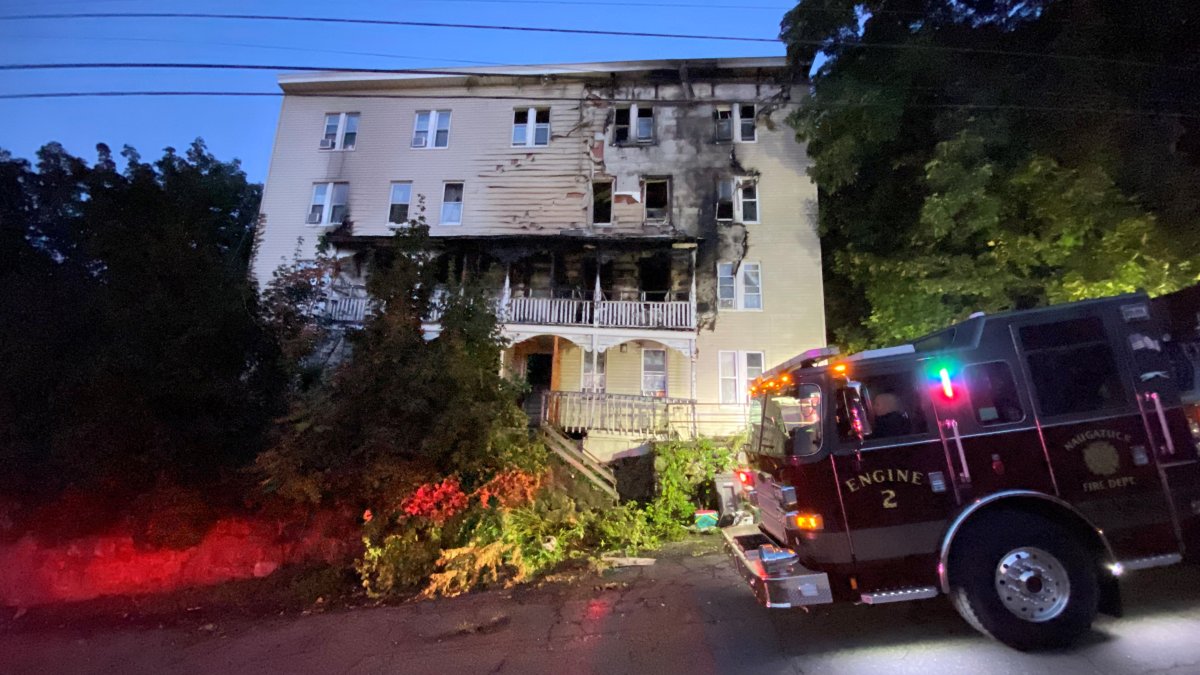 One person taken to burn unit after Naugatuck fire – NBC Connecticut