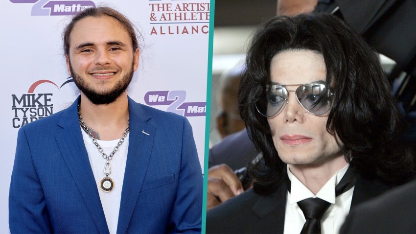 vitiligo michael jack