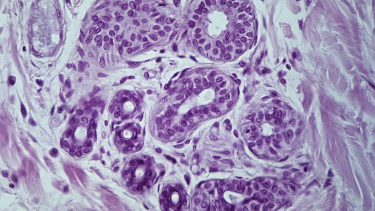 Can your sweat turn blue? – NBC Connecticut