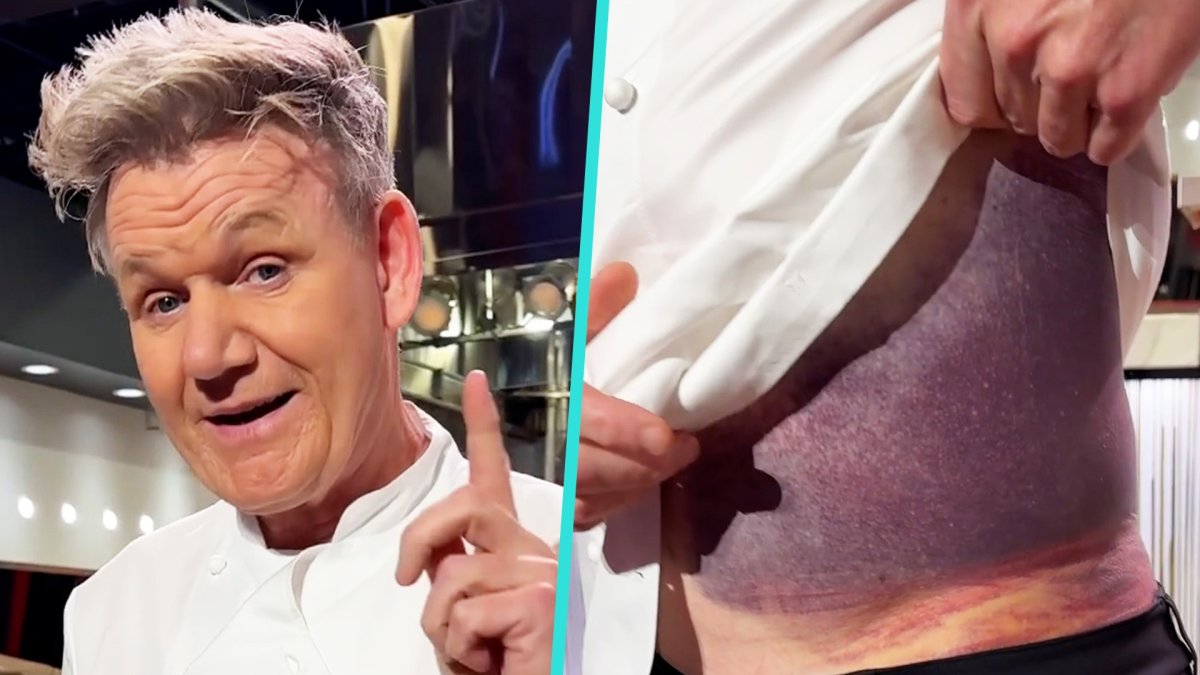 Gordon Ramsay reveals massive bruise after bike accident – NBC Connecticut