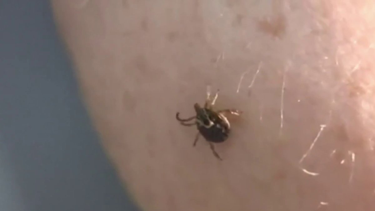 Experts say now is the time to start checking for ticks – NBC Connecticut