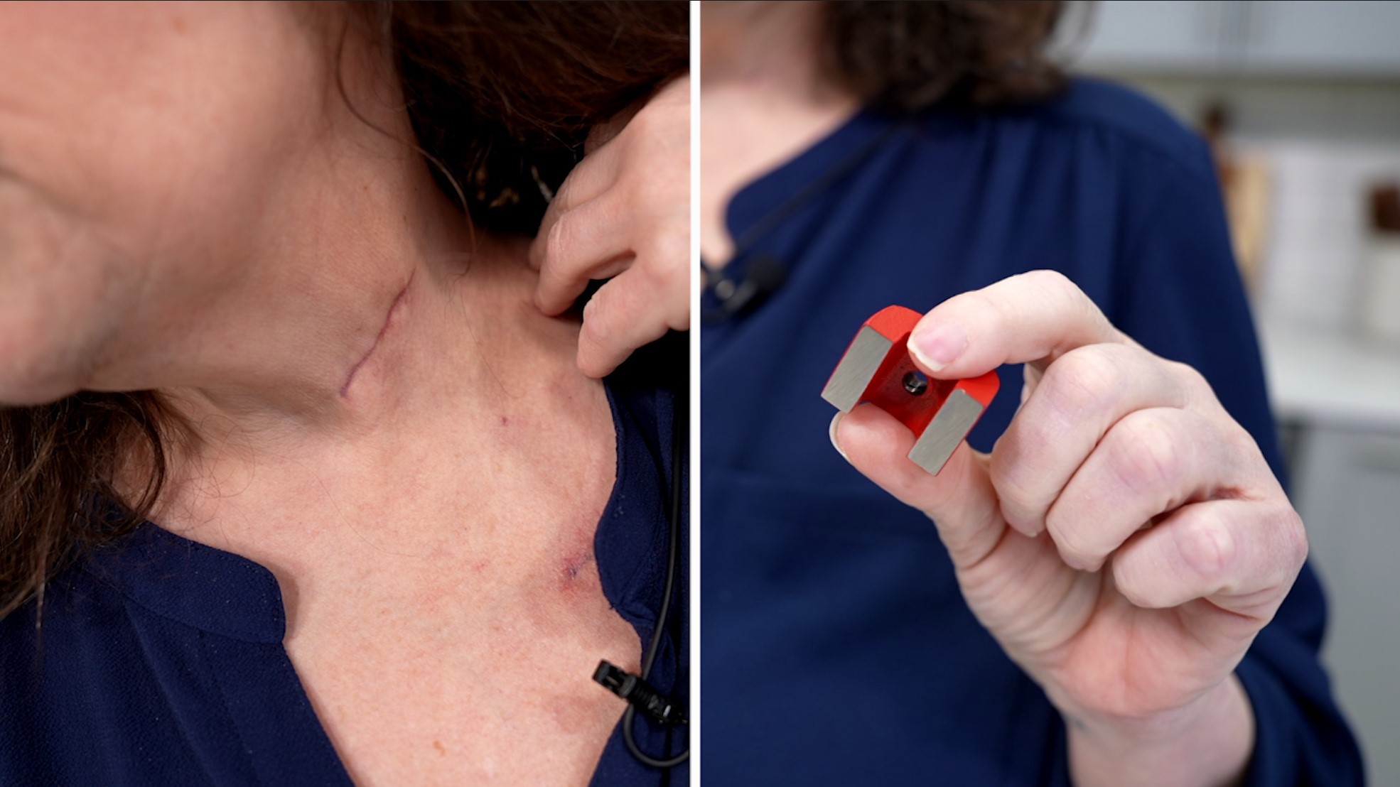 ‘Frustrating, disgusting, heartbreaking’ | Stroke survivor describes ...